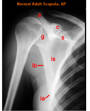 Doctors Gates: Radiographic Anatomy of Scapula