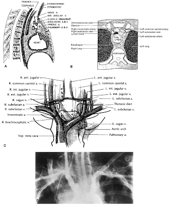 ON - RADIOLOGY: Applied anatomy of the vital structures posterior to ...