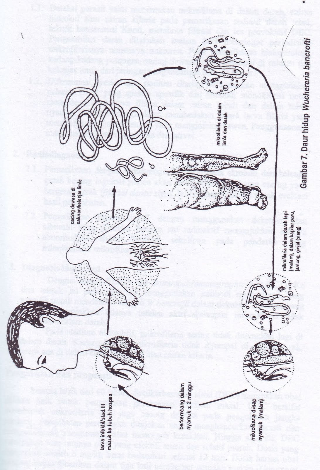 Lord Of The Darkness: Filariasis