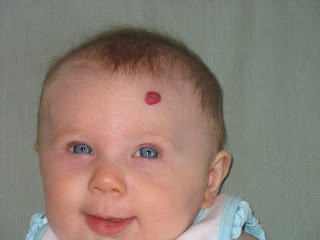 Not Wifezilla: The Birthmark & The Bump - Revisited