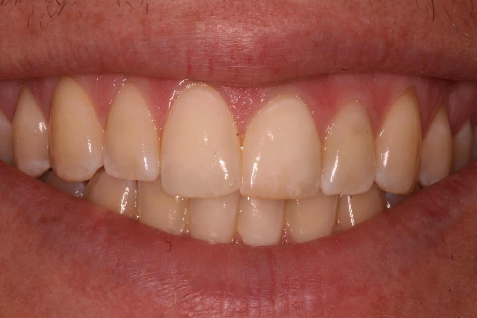 The Daily Grind: External Marketing