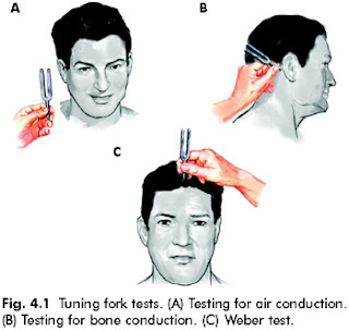 MEDICAL MNEMONICS: Rinne's test