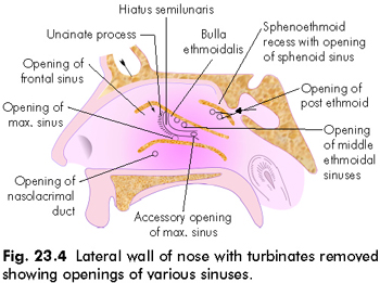 MEDICAL IMAGES: Lateral wall of nose