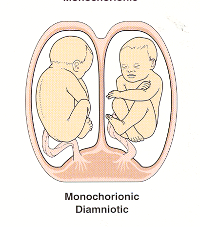 MEDICAL IMAGES: Monochorionic diamniotic