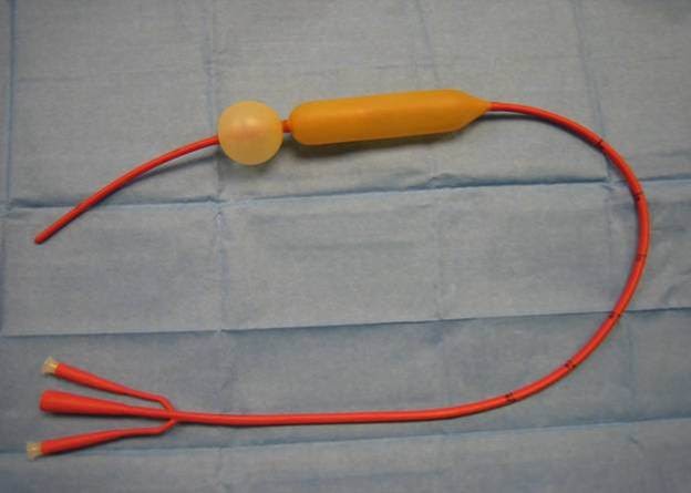 MEDICAL IMAGES: Sengstaken-Blakemore tube