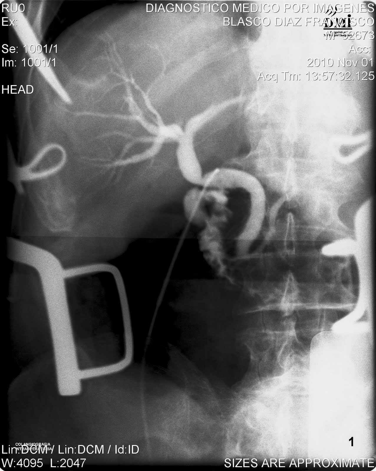 Diagnostico por Imagen: COLANGIOGRAFIA OPERATORIA