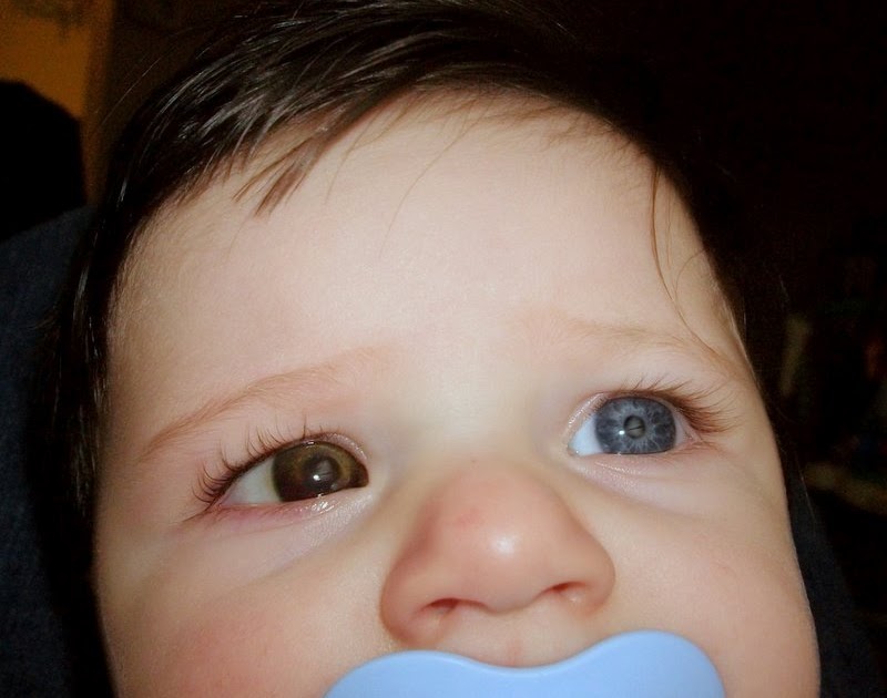 Cloth Chronicles: The Year of the Hyphema