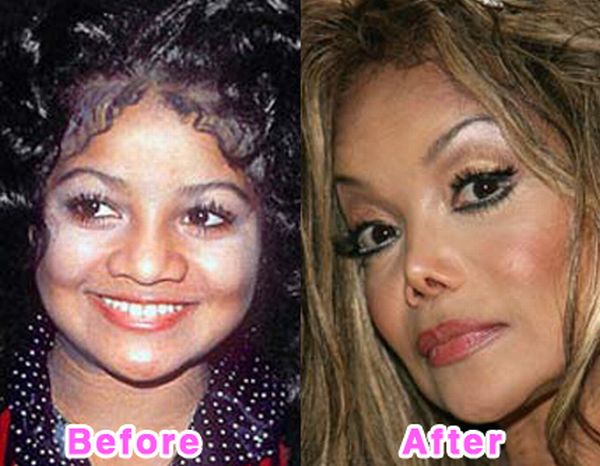 Weird: 16 Worst Celebrity Plastic Surgery Disaster