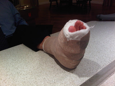 Journey: Big Toe Fusion--Live Surgery Results