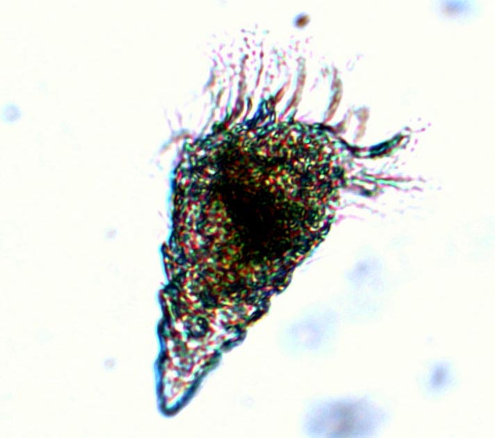 BOHEMIAN adventures: Bering Sea Day 16-17 - totally radical plankton