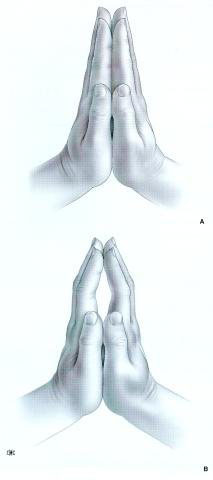 Taysir assistance الإسعاف الطبي تيسير: Signe du « prieur »