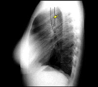 Apuntes de medicina: Radiografía de Tórax. Evaluación inicial.