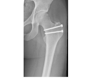 ICandy NZ: X-Ray Timeline