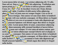 Scintillating Scotoma