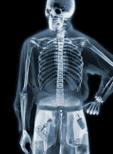 Ultimate Examples of X-Ray Photography by Nick Veasey | ~Spicx~