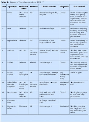 Dance Injury and Ehlers-Danlos Type III Hypermobility Syndrome: EDS ...