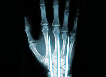 Suggestion: Blade Below The Shoulder - TV Tropes Forum