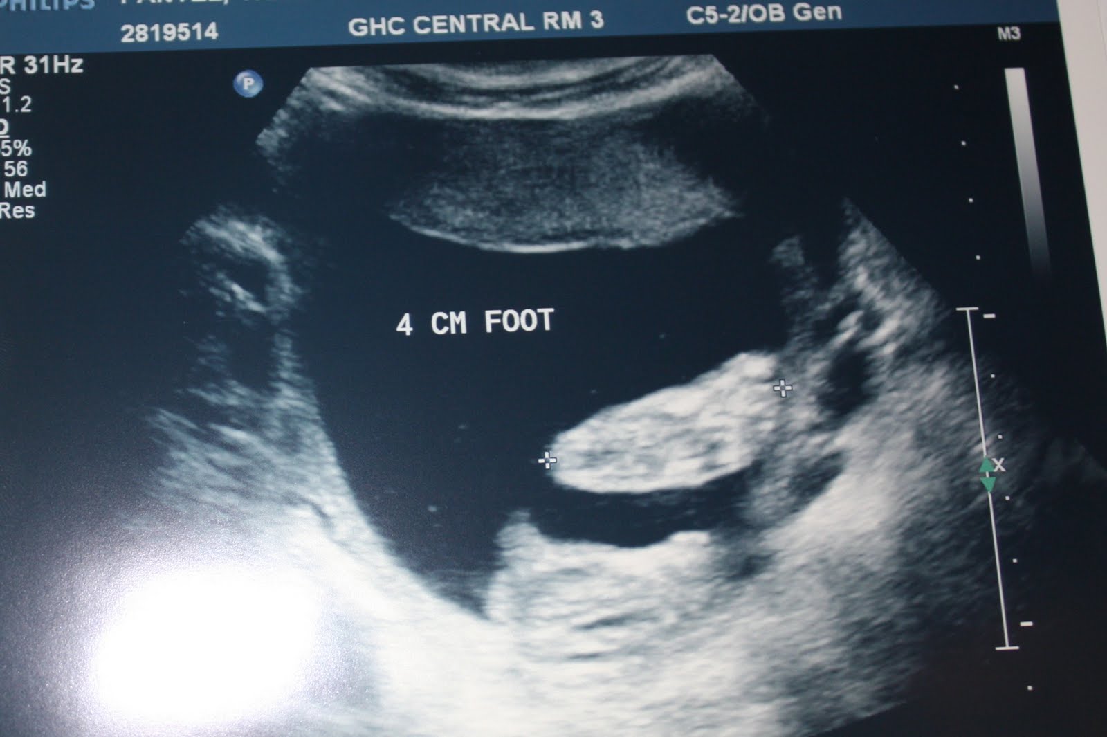 Pantel Family Blog: 21 week ultrasound