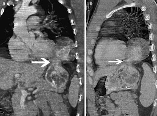 Radiodiagnosis mcqs postgraduation entrance preparation: 7 - The Collar ...
