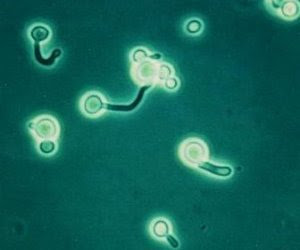 Microbiology Mcqs Post graduation entrance preparation: 17 - Germ Tube test