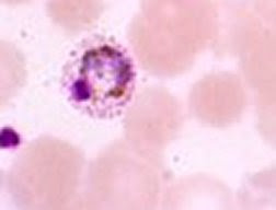 Microbiology Mcqs Post graduation entrance preparation: 19 - Schuffner ...