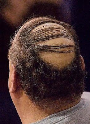 Curious, Funny Photos / Pictures: Bald men hairstyles - 29 Pics