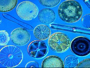 Chrysophyta Diatoms