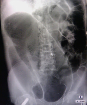 Journey of A Medie: On the Coffee Bean Sign