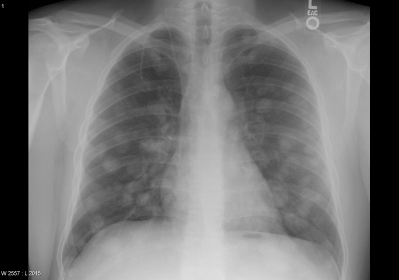 Dr Grumble: Off with their heads