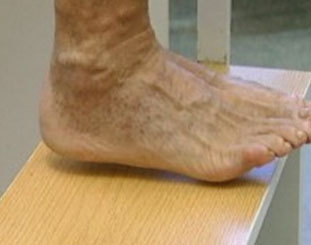 Zdravlje: Slabost vena