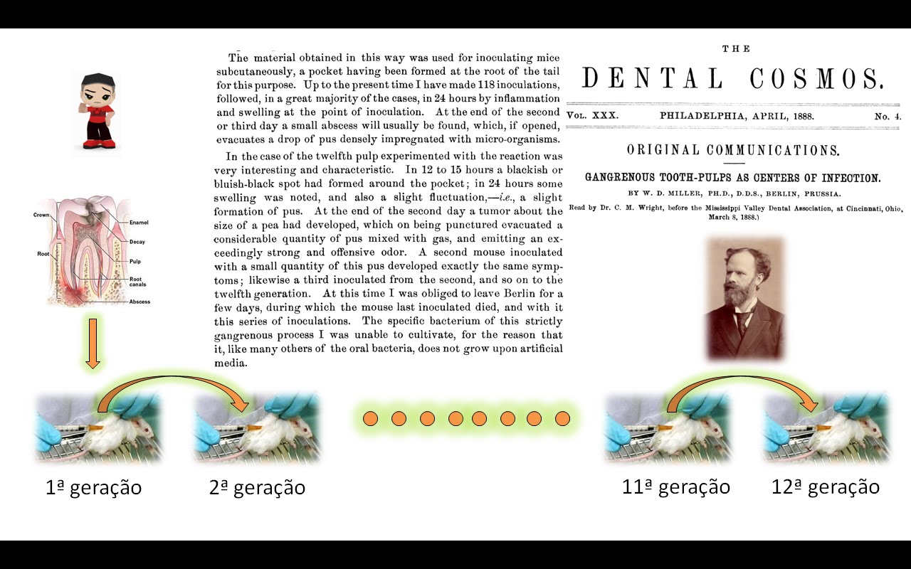 ENDOCICLADOR - uma nova abordagem endodôntica: Polpa dentária necrosada ...