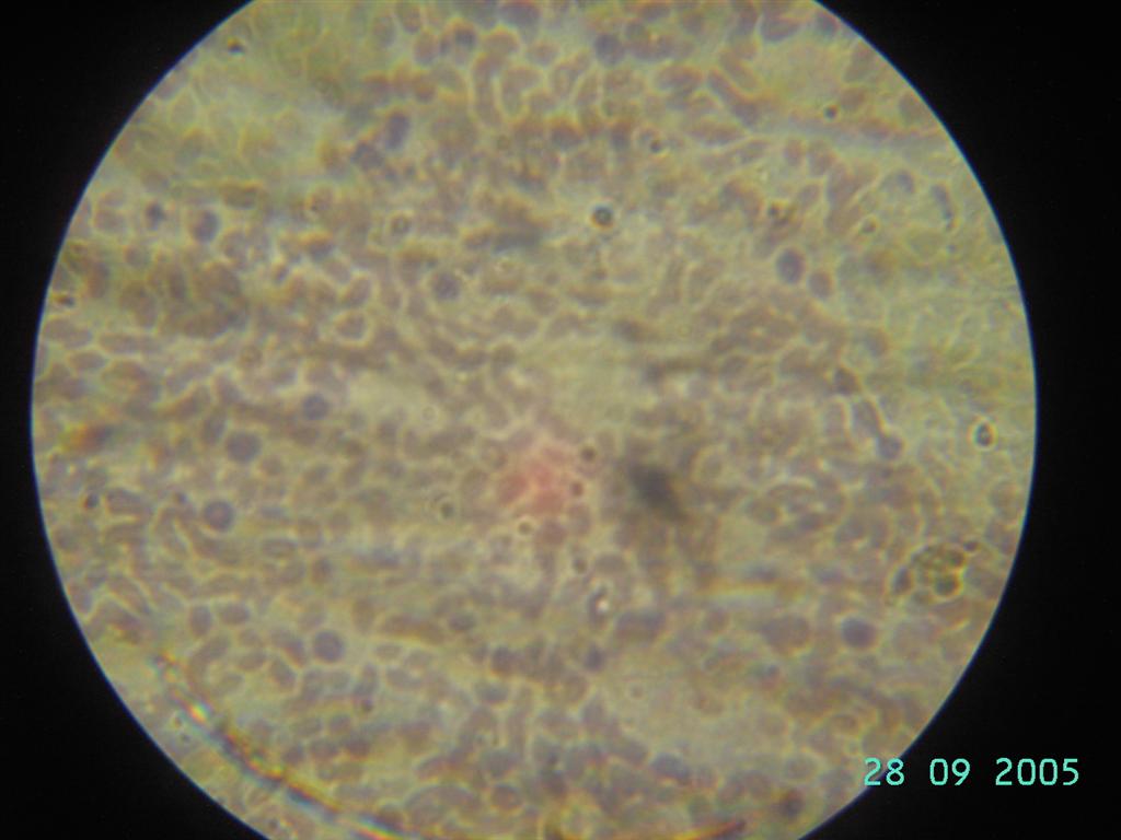 TuttyFrUiTyMixture.blogspot.com: camel rbc's (red blood cells ...