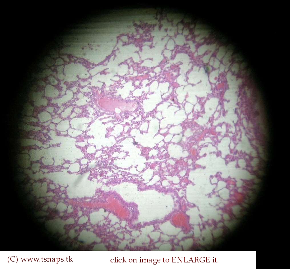 Histology Slides Database: lung histology slide