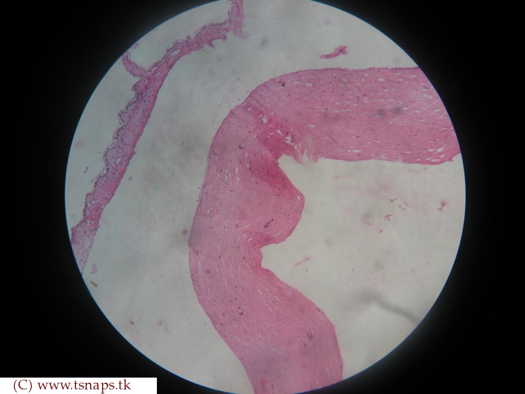 Histology Slides Database: Cornea of eye histology slide