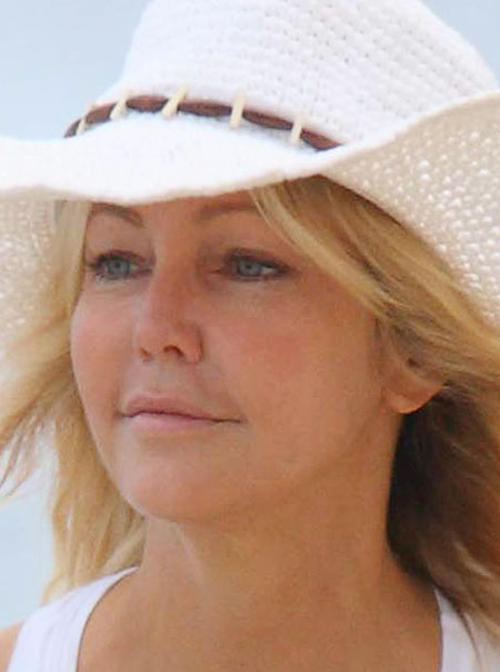 Ichik Ichik Ehem: Heather Locklear Plastic Surgery