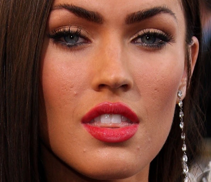Megan Fox Acne Scars