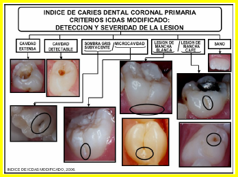 ICDAS :: Sonriefelizcict