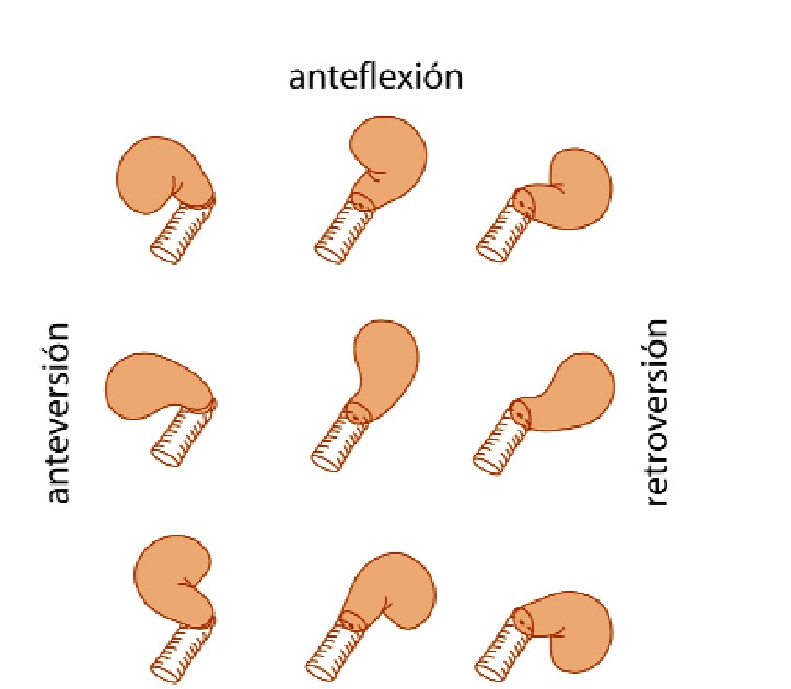la esterilidad: algunas respuestas a sus dudas: ¿Es importante la ...