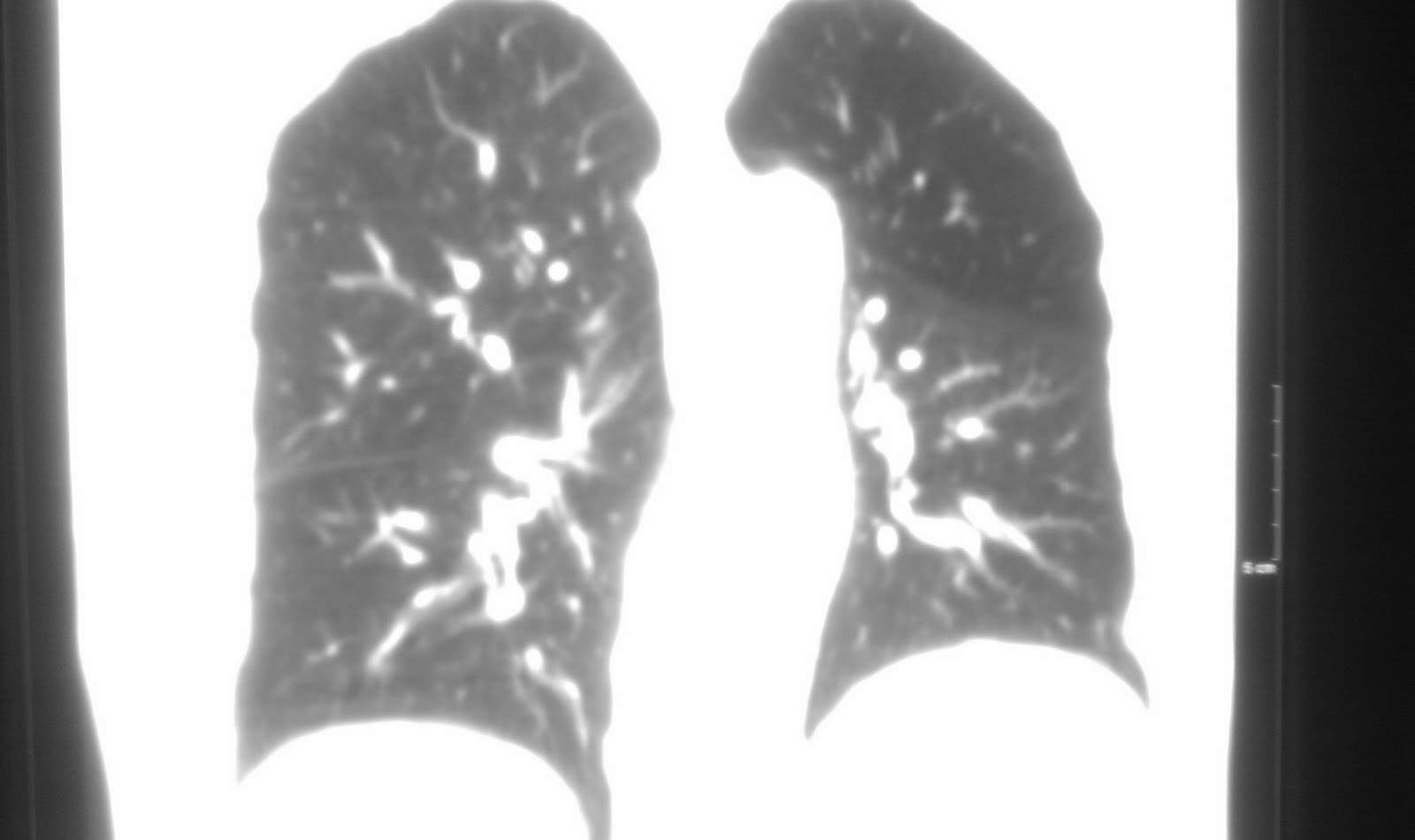 Daily Dose: November 2010