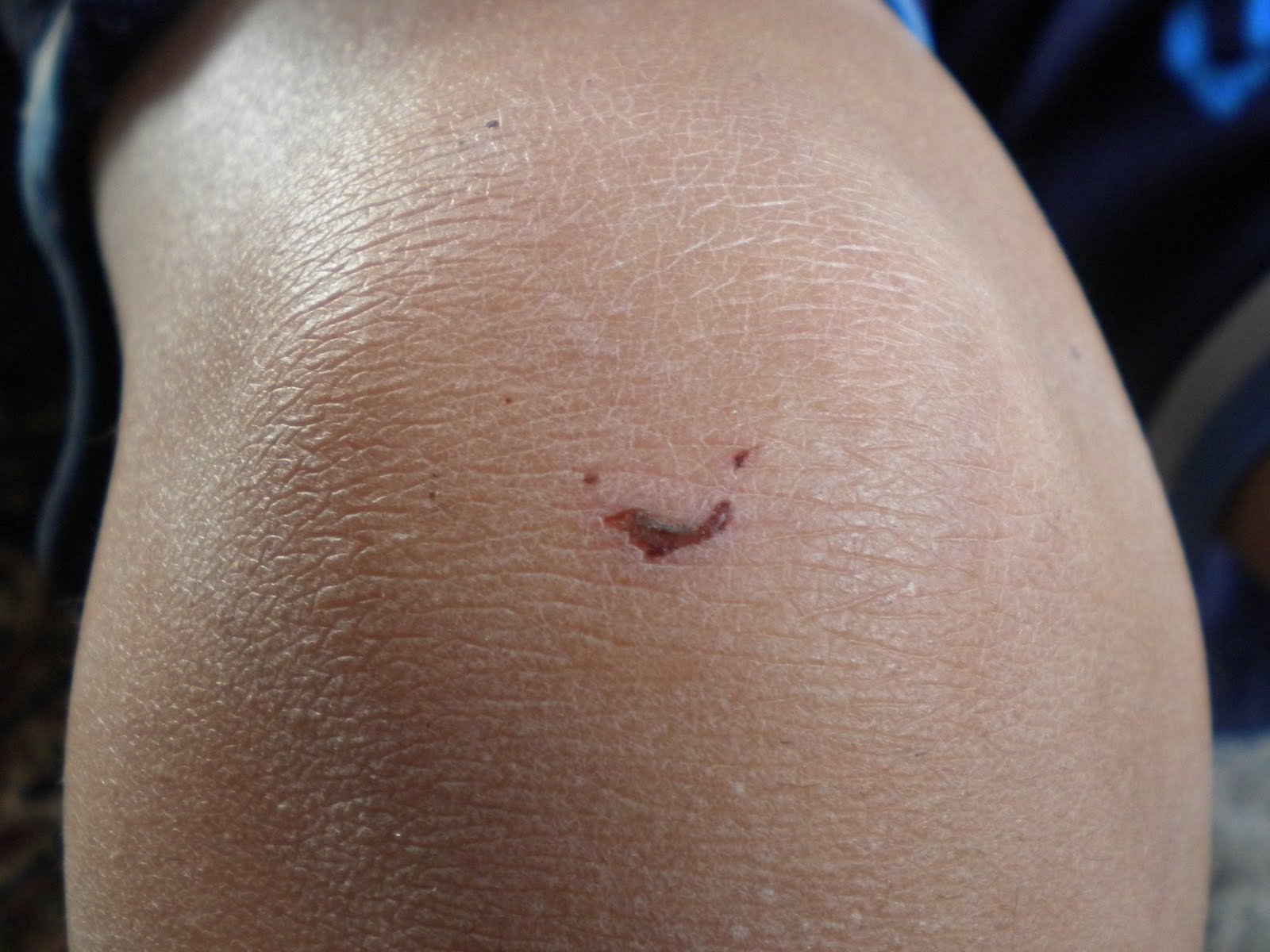 Mother Bliss: Sage's Cute Scab