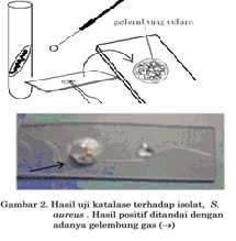 Analis Poenya Kendari: “ ISOLASI DAN IDENTIFIKASI BAKTERI ...