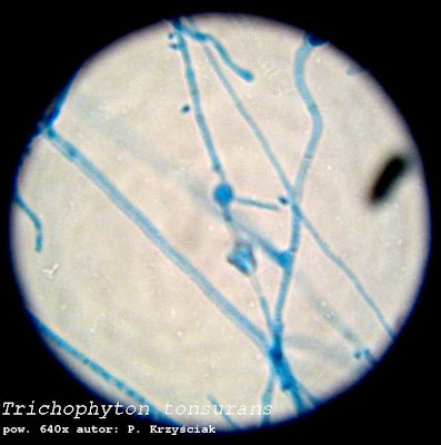 Mój malutki świat: Trichophyton tonsurans