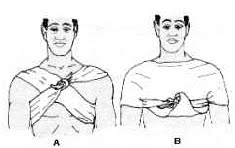 UAL-APRENDER PRIMEROS AUXILIOS ES FACIL. : Tipos de Vendaje
