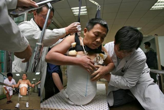 layarminda2: Peng Shulin, Manusia Separuh Badan.