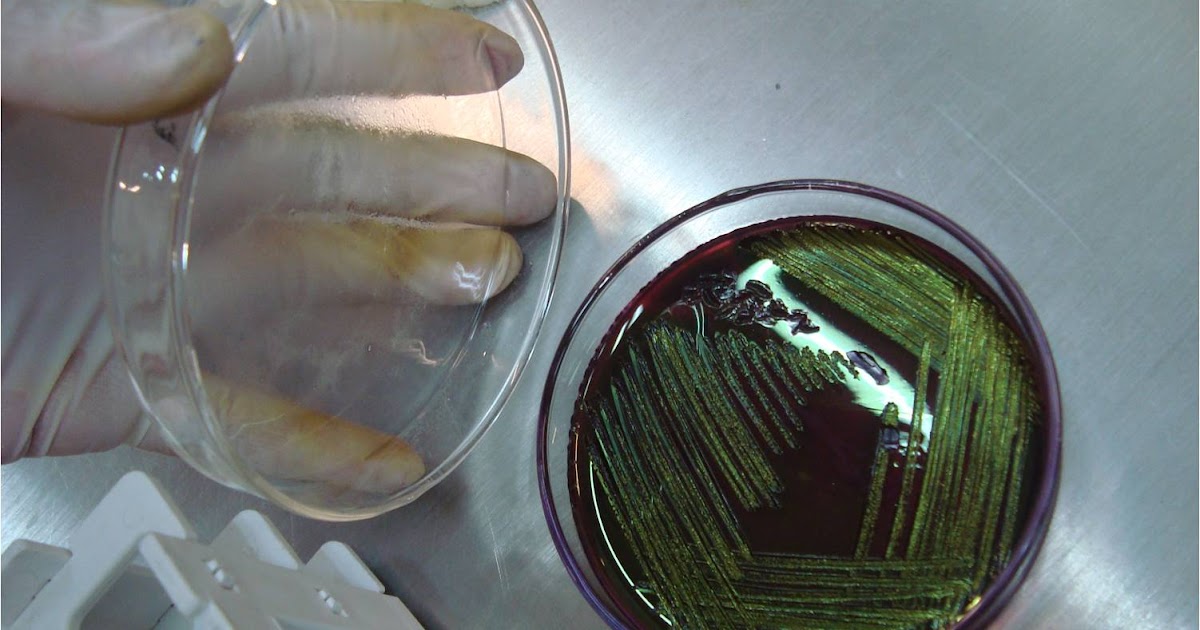 BACTERIOLOGIA Y LAB. CLINICO: ¿Que es Bacteriologia y Laboratorio Clinico?