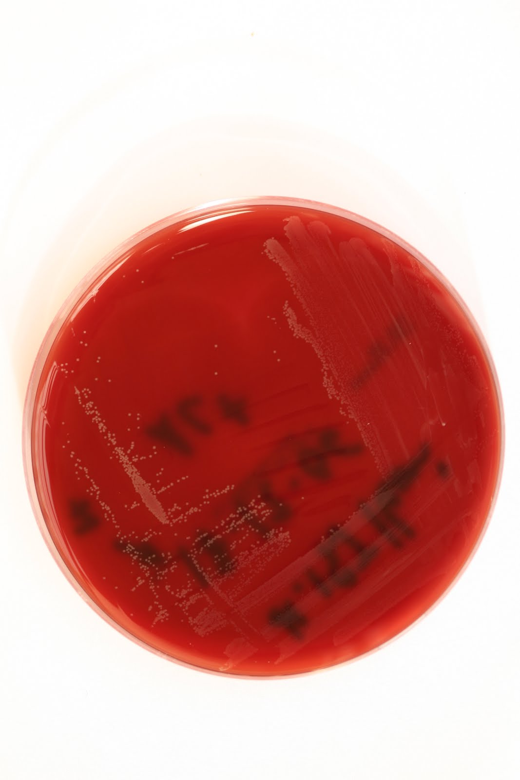 LABORATORIO Y FOTOS MICROBIOLOGÍA: GÉNERO CAMPYLOBACTER.