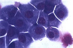 JAČANJE IMUNITETA ORGANIZMA: Limfociti