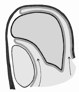 The Morrison's Pouch