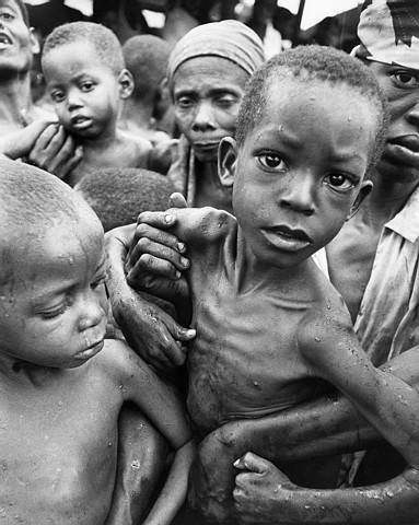They Starve From Hunger!!!: Hungry Children Pics