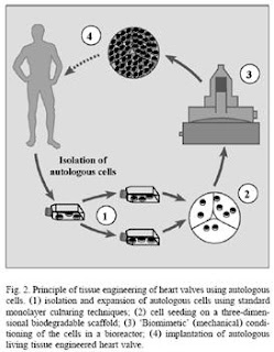 BE115's Tissue Engineering Blog: Review: Heart valve tissue engineering